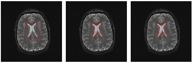 Area and Length Minimizing Flows for Shape Segmentation